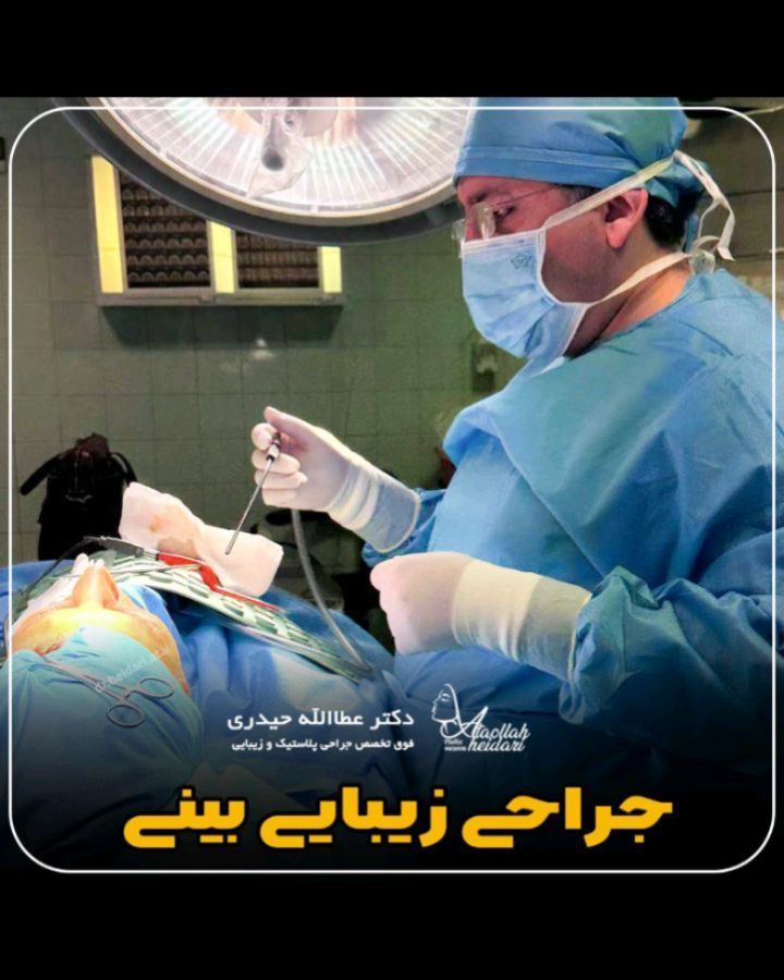 dr.heidari.ata@instagram on Pinno: . جراحی زیبایی بینی دکتر عطالله حیدری 🔺...