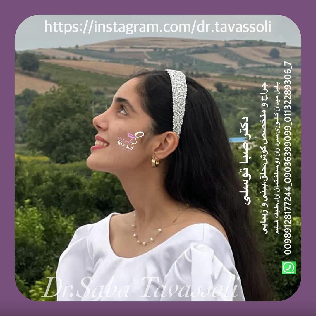 Dr Tavassoli Instagram On Pinno عکس ارسالی،یکسال بعد از عمل🥰😍😍
