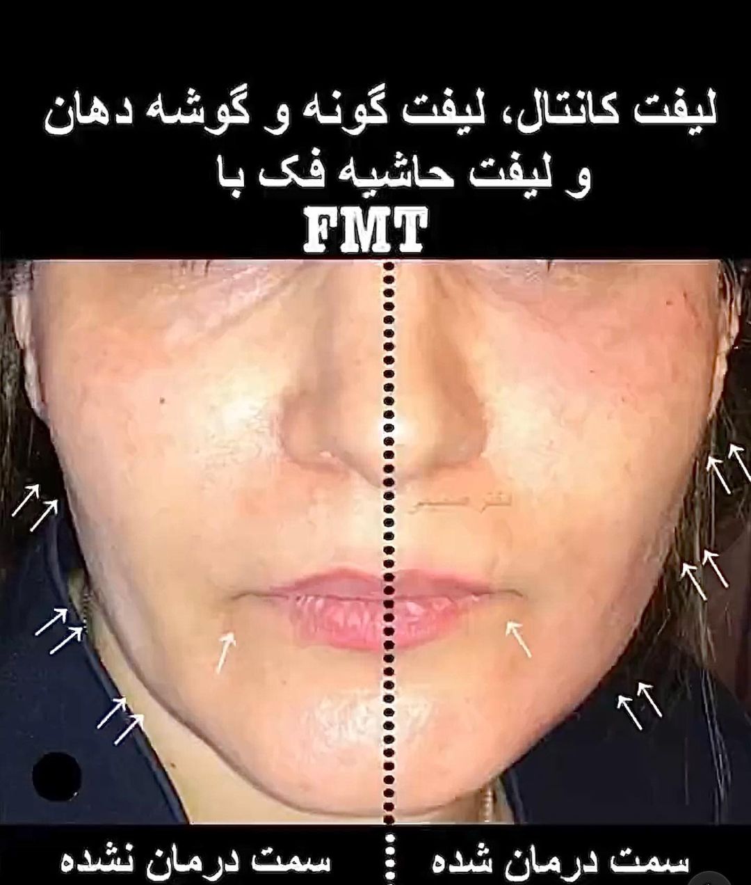 dr.rambod.samimi@instagram on Pinno: پرسش راجع به روش انحصاری من در ...