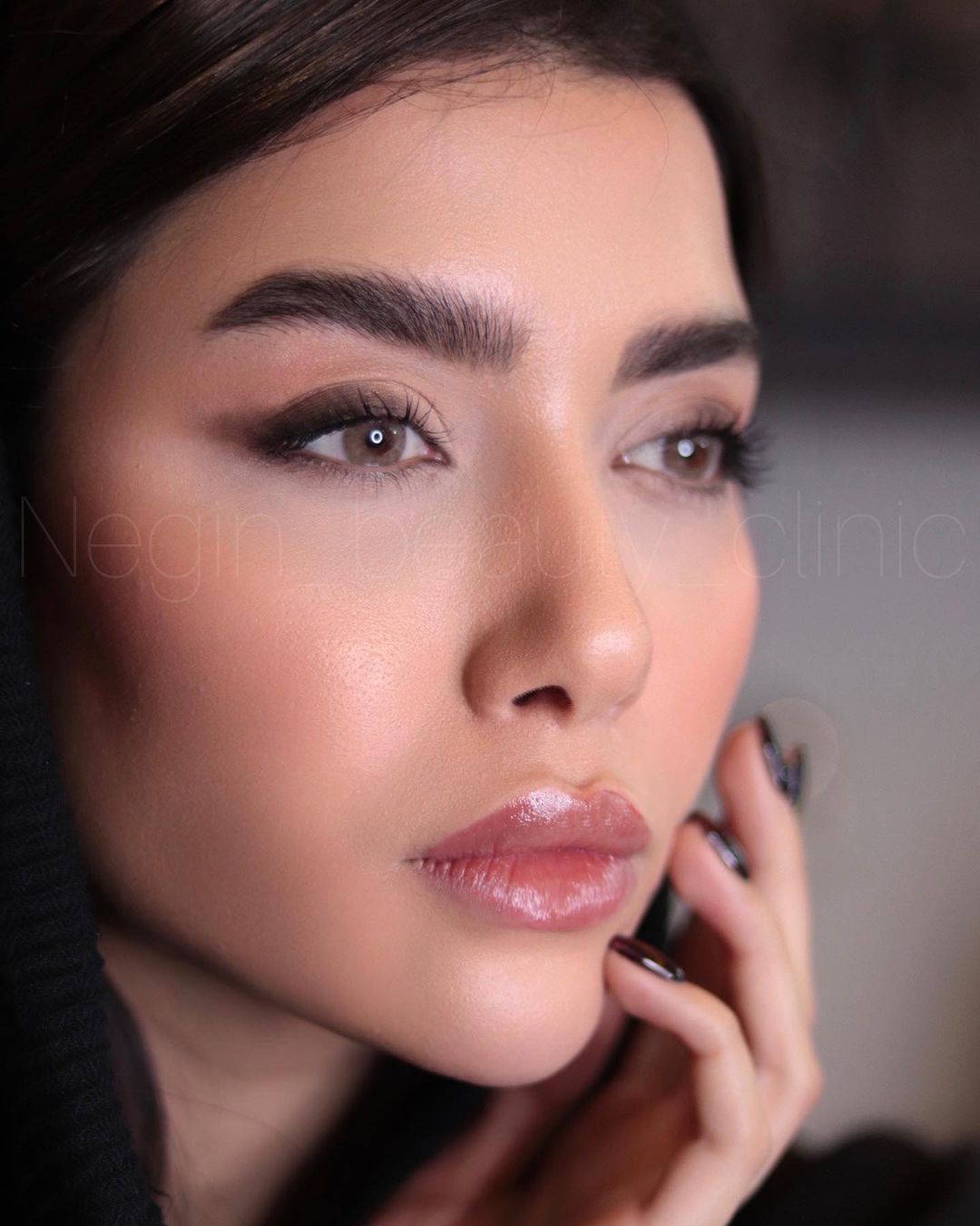 negin_beauty_clinic@instagram on Pinno: فرمدهی لب و چانه 😍 اگر دنبال ی تغییر مثبت تو صورتتی بهت ...