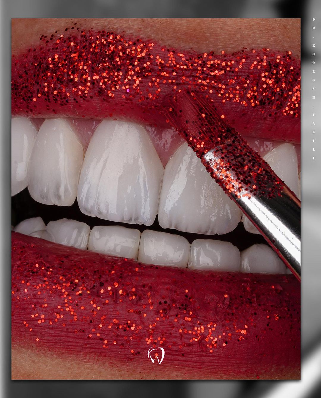 dr.koorosh.vakili@instagram on Pinno: • LAMINATE BL1 color with halo ...